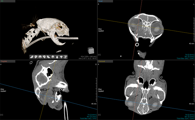 Helical-Linear CT Scanner - Helical CT Scanner - woorien