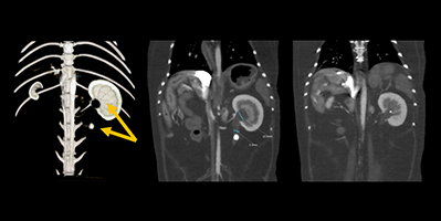 Helical-Linear CT Scanner - Helical CT Scanner - woorien