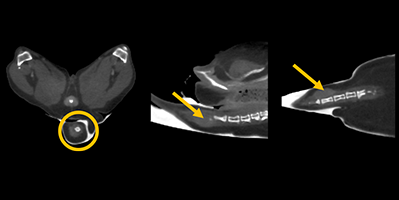 Helical-Linear CT Scanner - Helical CT Scanner - woorien